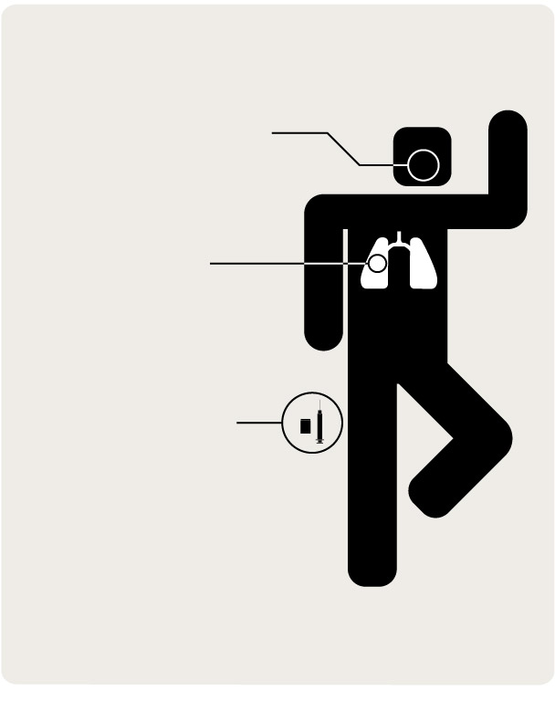 These people used Narcan to save a life. Here’s how they did it ...